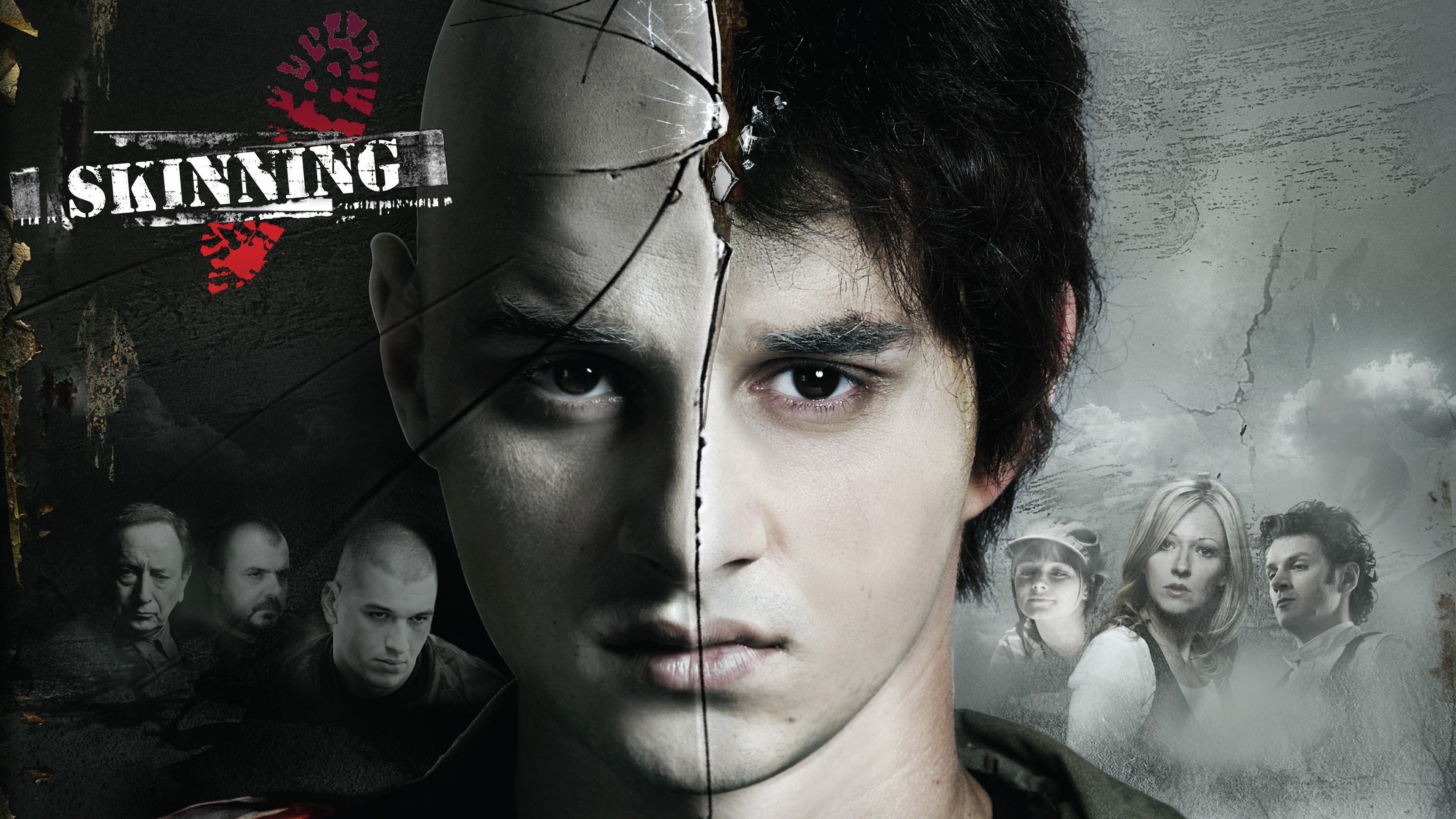 Skinning (2010) - Plex